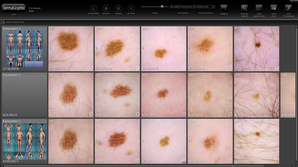 How To Check A Mole Resolutionrecognition4
