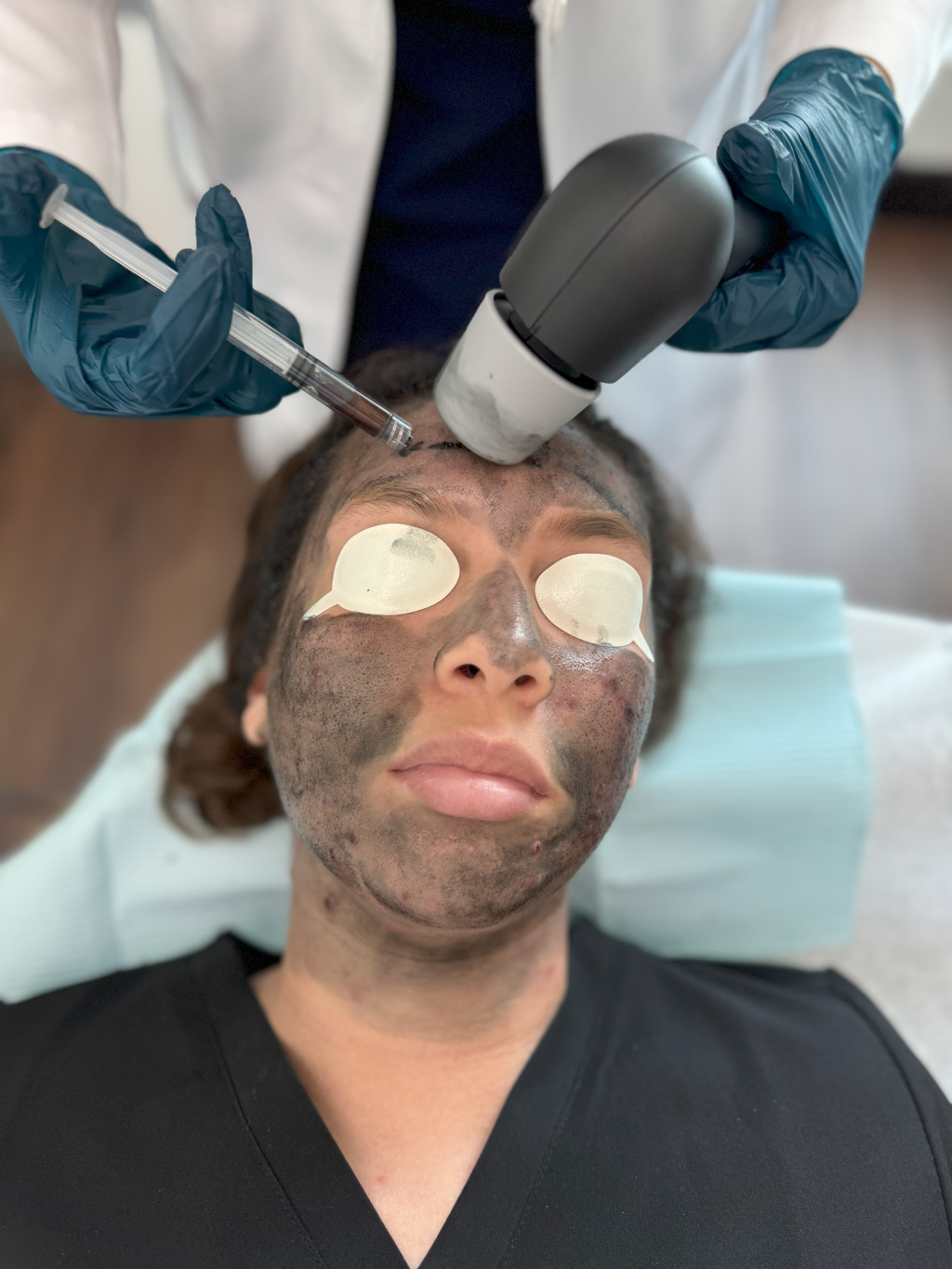 Sebacia Acne Treatment | Clearer Skin with Gold Therapy